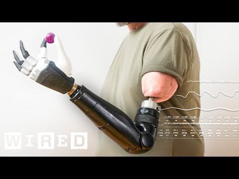 Chrome Happens! - How Mind-Controlled Bionic Arms Fuse To The Body ...